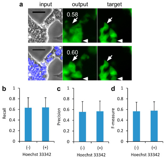 Deep Learning of Phase-Contrast Images of Cancer Stem Cells Using a ...