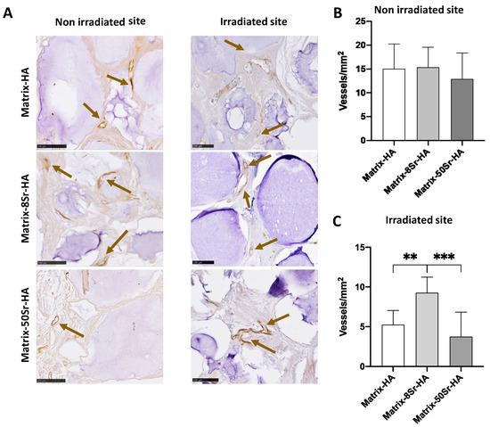 Bone Regeneration in Small and Large Segmental Bone Defect Models after ...