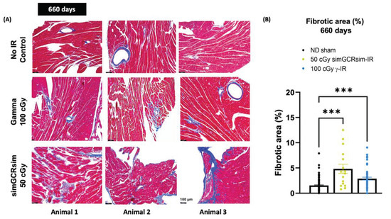 Lifetime Evaluation of Left Ventricular Structure and Function in Male ...