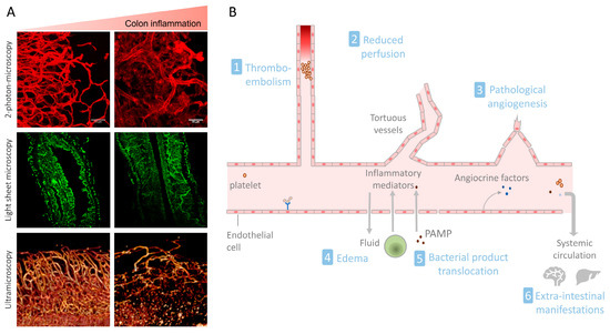 Contribution of Blood Vessel Activation, Remodeling and Barrier ...