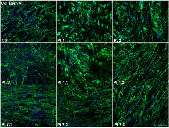 Extracellular Matrix Disorganization and Sarcolemmal Alterations in ...