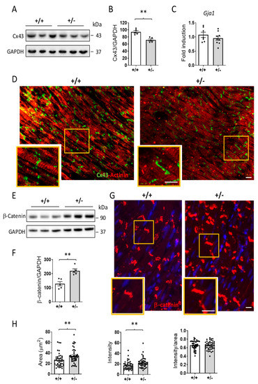 Cardiac Functional and Structural Abnormalities in a Mouse Model of ...