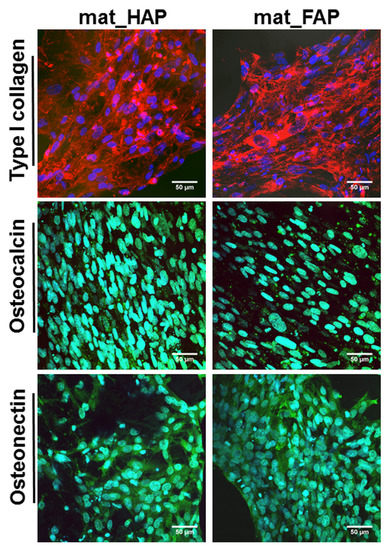 Hydroxyapatite or Fluorapatite—Which Bioceramic Is Better as a Base for ...