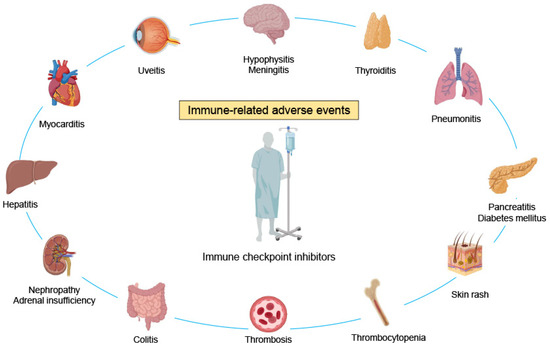 Rheumatic Immune-Related Adverse Events due to Immune Checkpoint Inhibitors—A 2023 Update