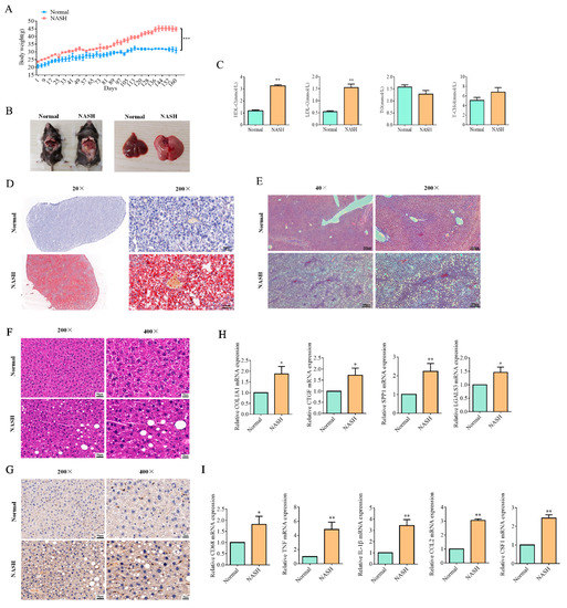 Resmetirom Ameliorates NASH-Model Mice by Suppressing STAT3 and NF-κB ...