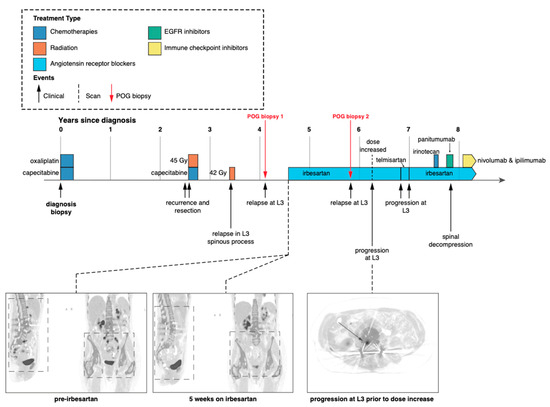 Immune Activation Following Irbesartan Treatment in a Colorectal Cancer ...