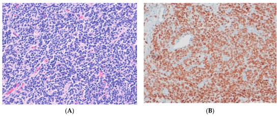 The Recent Advances in Molecular Diagnosis of Soft Tissue Tumors