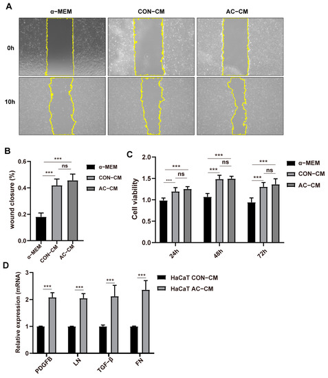 IJMS | Free Full-Text | dCas9-Based PDGFR–β Activation ADSCs Accelerate ...