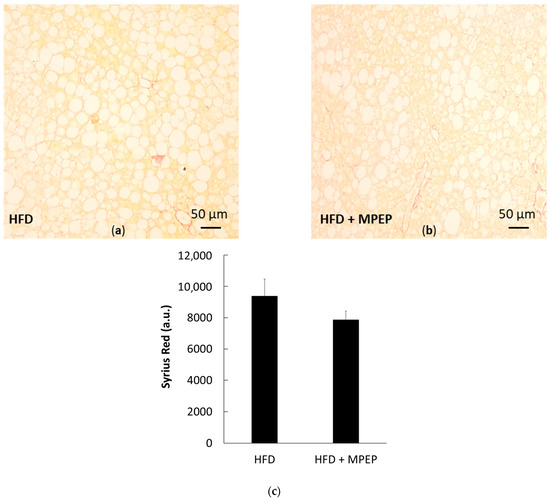 IJMS | Free Full-Text | MPEP Attenuates Intrahepatic Fat Accumulation ...