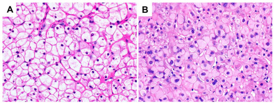 The Liver and Glycogen: In Sickness and in Health