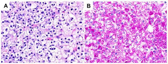 The Liver and Glycogen: In Sickness and in Health
