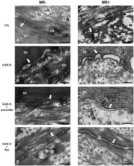 Interactions between Malassezia and New Therapeutic Agents in Atopic ...