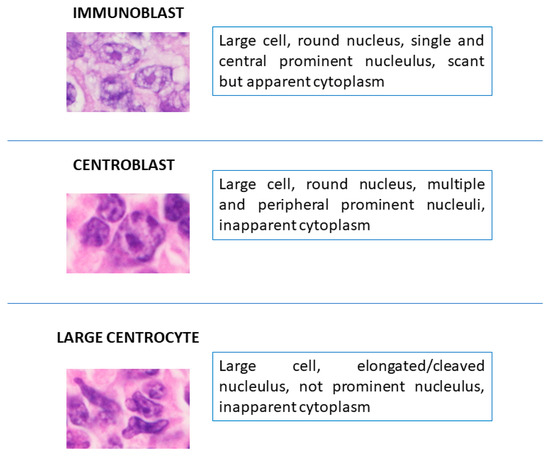 Primary Cutaneous B-Cell Lymphomas with Large Cell Morphology: A Practical Review