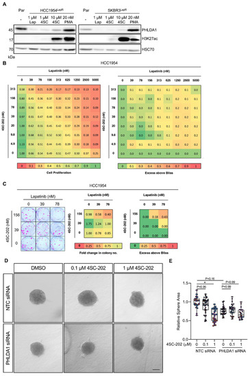 HDAC Inhibition Restores Response to HER2-Targeted Therapy in Breast ...