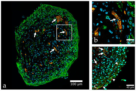 3D Tumor Models in Urology