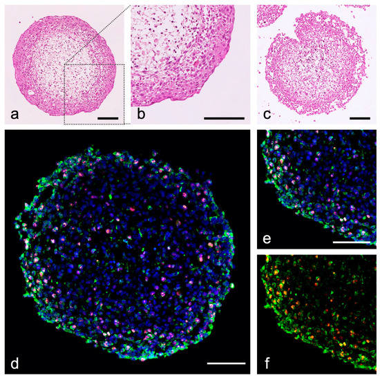 3D Tumor Models in Urology