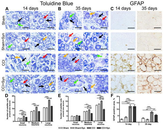 Anti-Inflammatory Activity of Synaptamide in the Peripheral Nervous ...