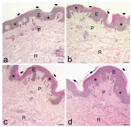 An Innovative Fluid Dynamic System to Model Inflammation in Human Skin ...