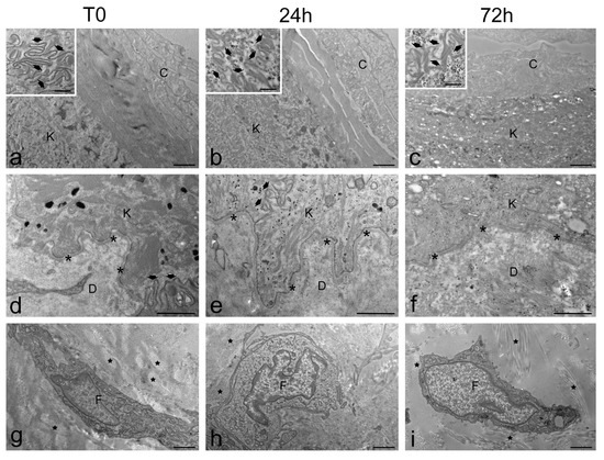 An Innovative Fluid Dynamic System to Model Inflammation in Human Skin ...