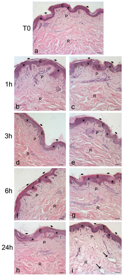 An Innovative Fluid Dynamic System to Model Inflammation in Human Skin ...