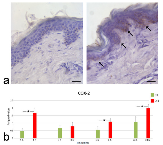 An Innovative Fluid Dynamic System to Model Inflammation in Human Skin ...