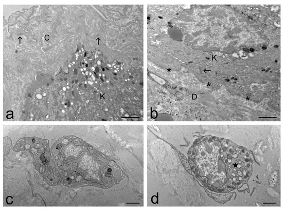 An Innovative Fluid Dynamic System to Model Inflammation in Human Skin ...