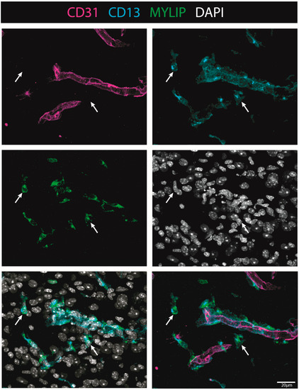 Mouse Spinal Cord Vascular Transcriptome Analysis Identifies CD9 and ...