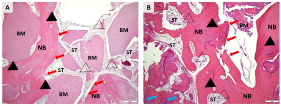 Osteogenic Potential of Autologous Dentin Graft Compared with Bovine ...