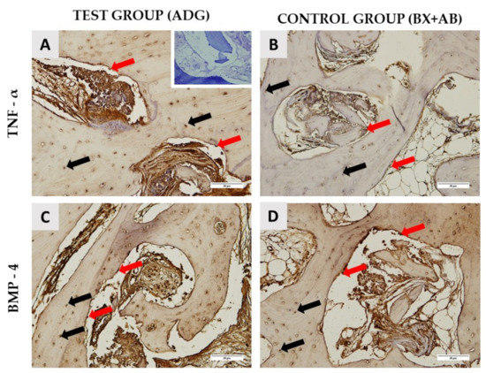 Osteogenic Potential of Autologous Dentin Graft Compared with Bovine ...
