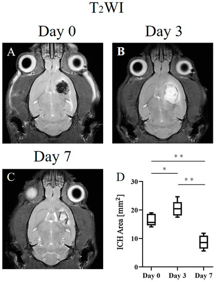 Quantitative Susceptibility Mapping and Amide Proton Transfer-Chemical ...