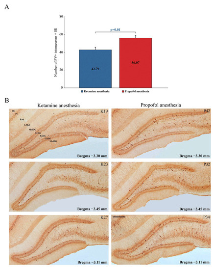 Different Alterations of Hippocampal and Reticulo-Thalamic GABAergic ...