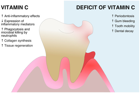 The Role of Vitamin C and Vitamin D in the Pathogenesis and Therapy of ...