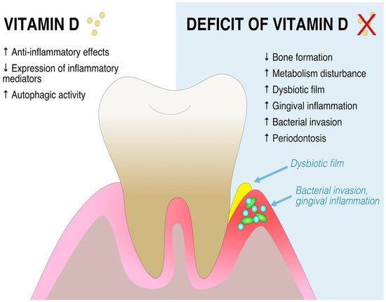 The Role of Vitamin C and Vitamin D in the Pathogenesis and Therapy of ...
