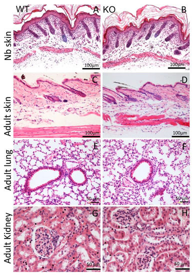 The Fraser Complex Proteins (Frem1, Frem2, and Fras1) Can Form ...