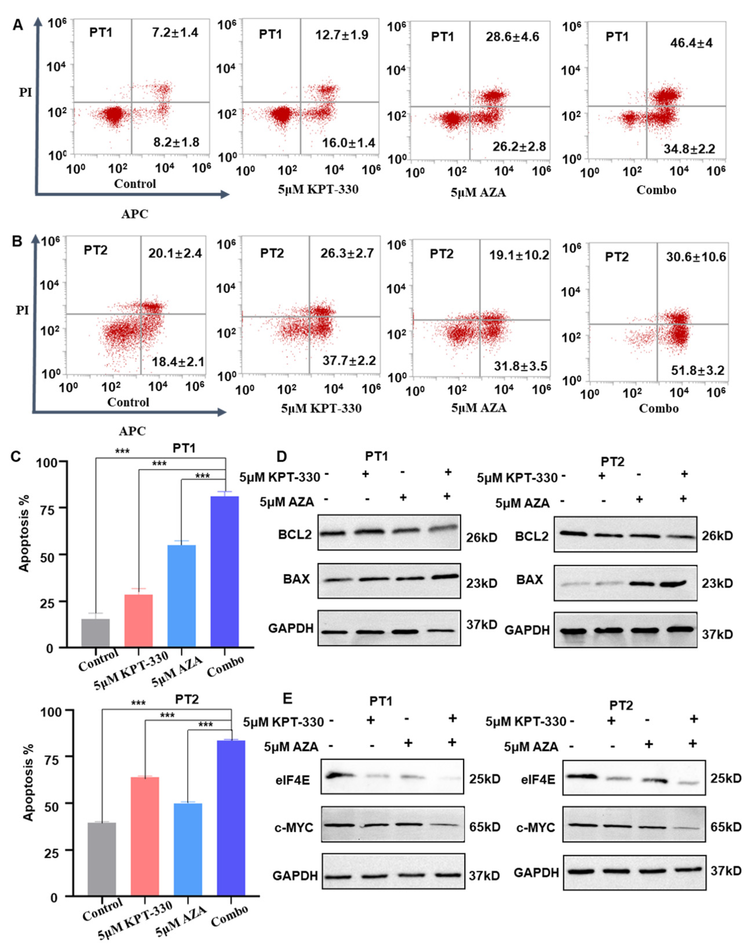 IJMS | Free Full-Text | Azacitidine Is Synergistically Lethal with XPO1 Inhibitor Selinexor in ...