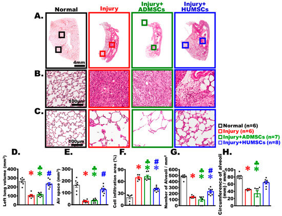 Reversal of Pulmonary Fibrosis: Human Umbilical Mesenchymal Stem Cells from Wharton’s Jelly ...