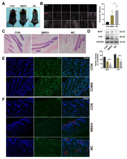 Optimization of Monobenzone-Induced Vitiligo Mouse Model by the ...
