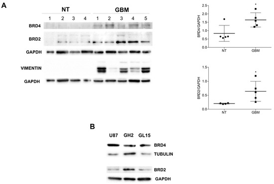 Bromodomain and Extraterminal Domain (BET) Protein Inhibition Hinders ...