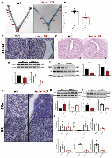 The Uterine Melatonergic Systems of AANAT and Melatonin Membrane ...