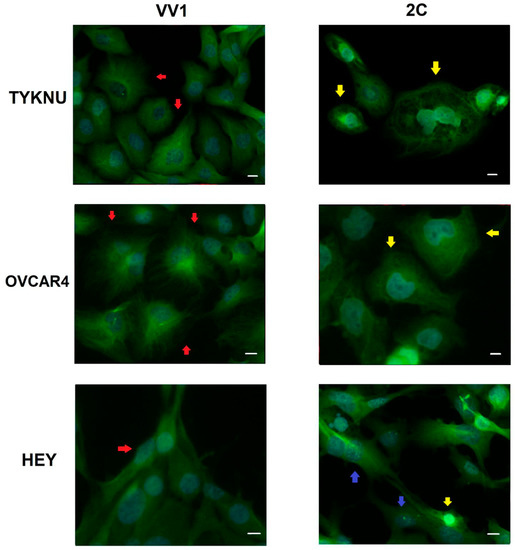 Nanomechanical Characterization of Ovarian Cancer Cell Lines as a ...