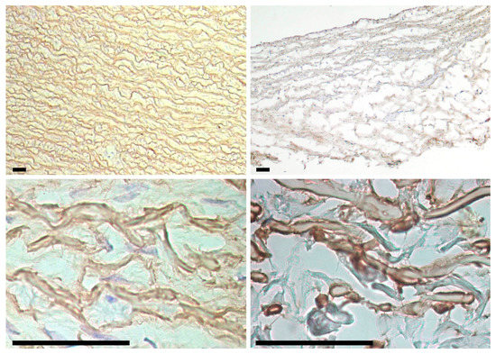 Calcification of Various Bioprosthetic Materials in Rats: Is It Really ...