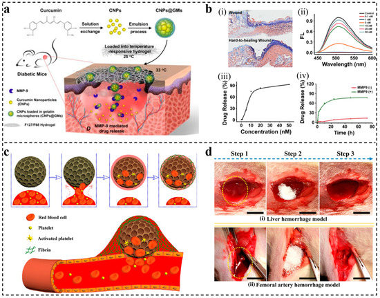 Application of Biomedical Microspheres in Wound Healing