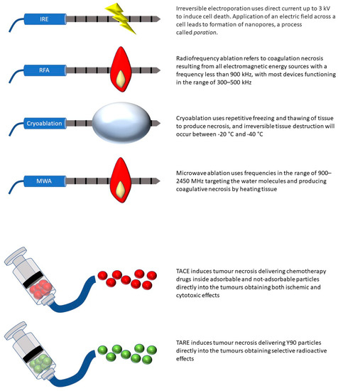 Interventional Oncology and Immuno-Oncology: Current Challenges and ...