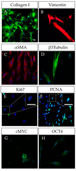 IJMS | Free Full-Text | Notch and Wnt Signaling Modulation to Enhance ...