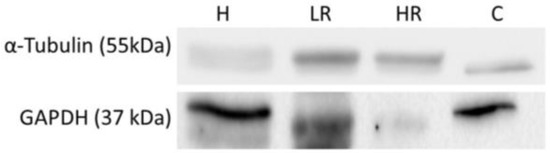 Isolation and Characterization of Extracellular Vesicles in Human Bowel ...