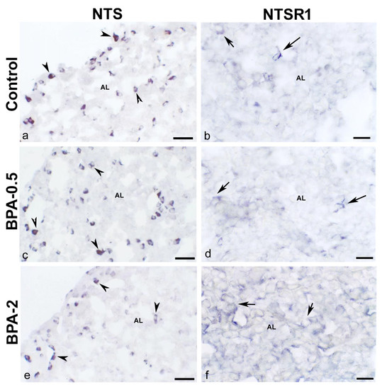 NTS, NTSR1 and ERs in the Pituitary–Gonadal Axis of Cycling and ...
