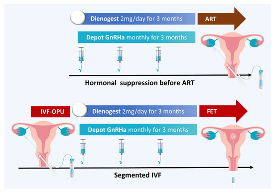 IJMS | Free Full-Text | A Lifelong Impact on Endometriosis: Pathophysiology and Pharmacological ...