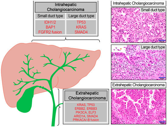 Targeting the Sequences of Circulating Tumor DNA of Cholangiocarcinomas and Its Applications and ...