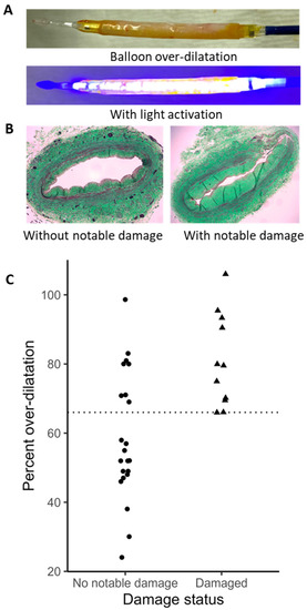 Photochemically Aided Arteriovenous Fistula Creation to Accelerate ...