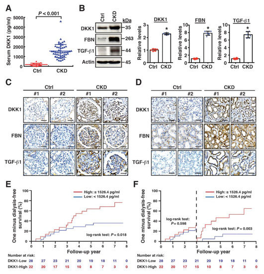 Dickkopf-1 Acts as a Profibrotic Mediator in Progressive Chronic Kidney ...